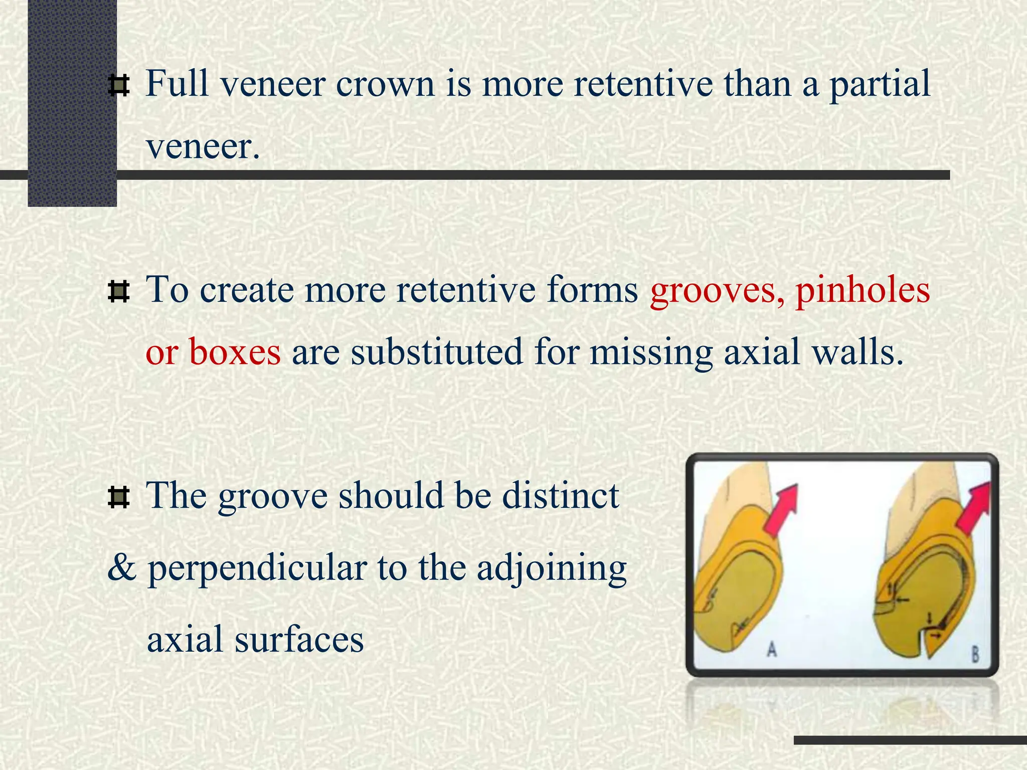 Biomechanical Principles of Tooth Preparation in FPD.ppt