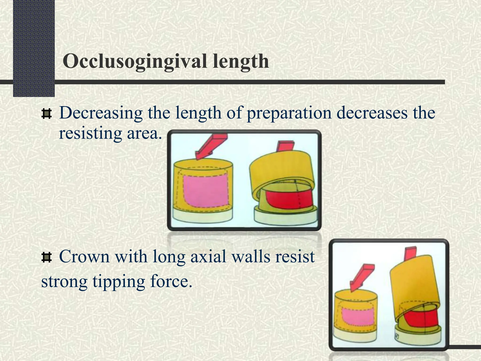 Biomechanical Principles of Tooth Preparation in FPD.ppt