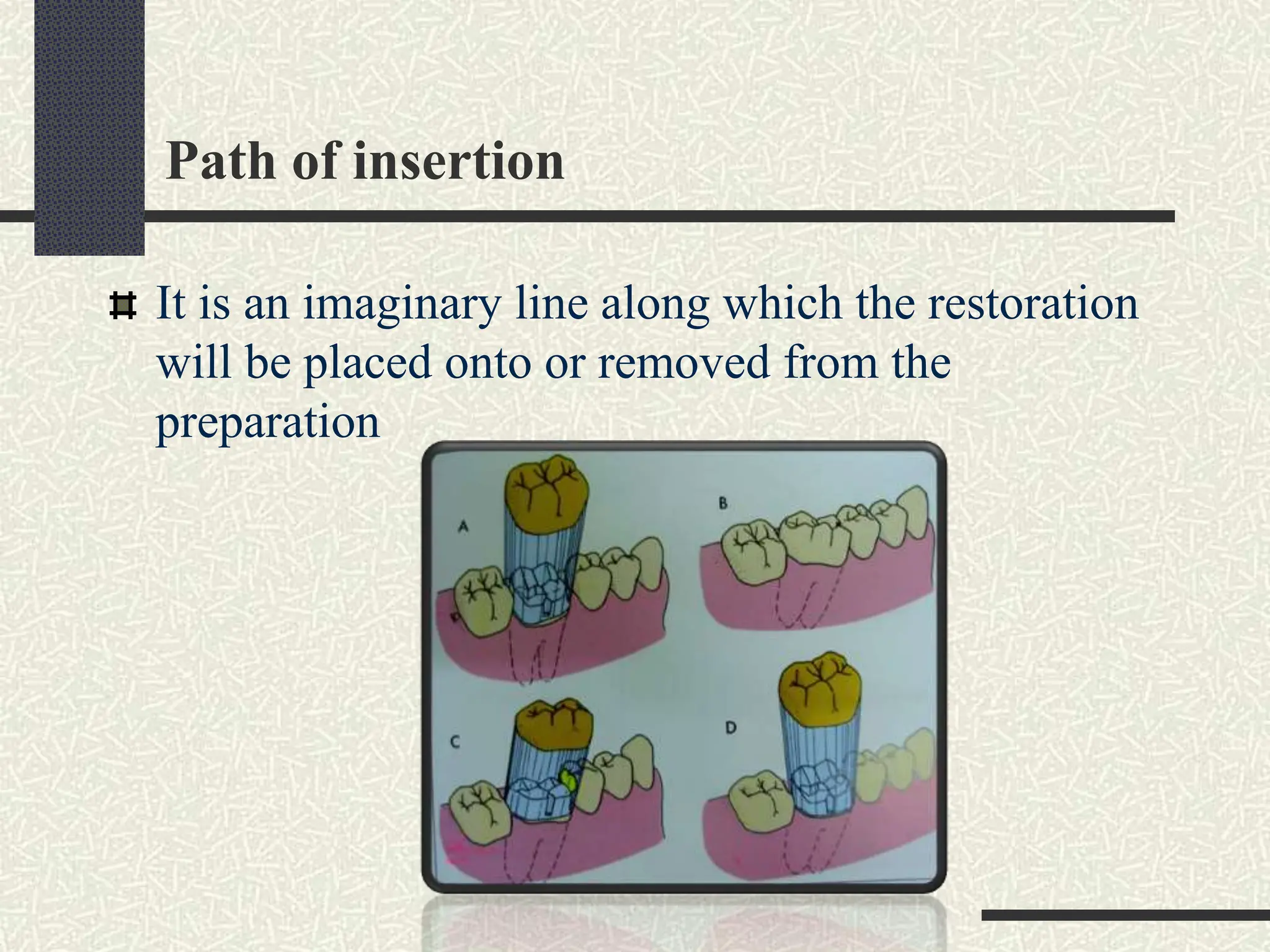 Biomechanical Principles of Tooth Preparation in FPD.ppt