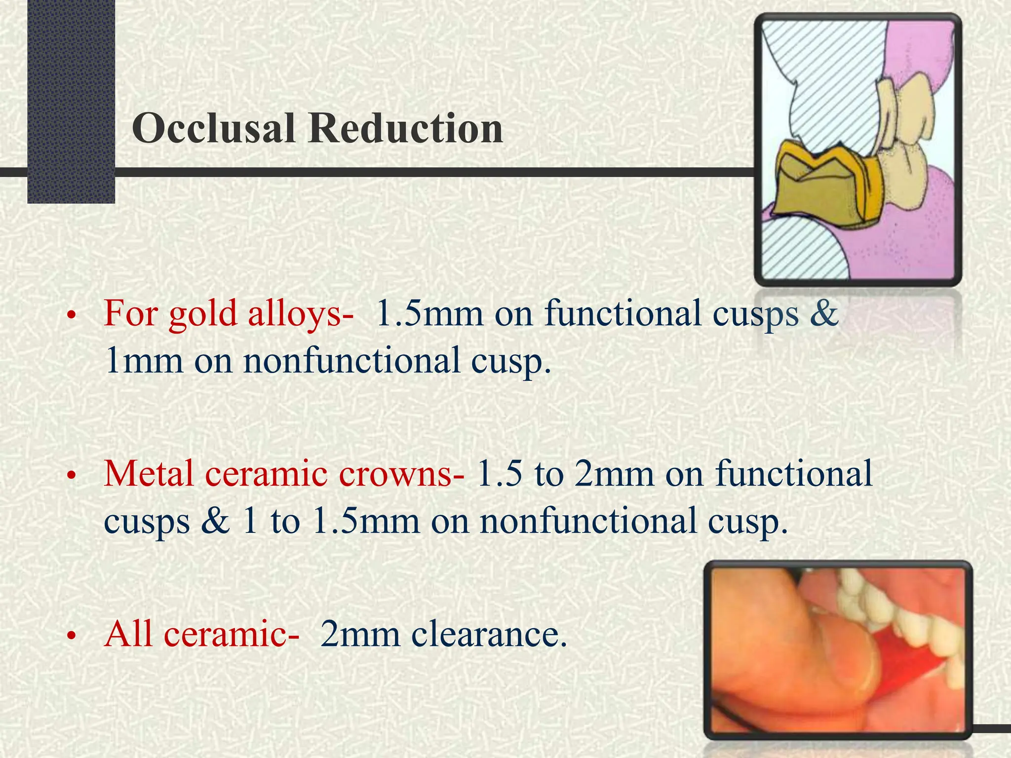 Biomechanical Principles of Tooth Preparation in FPD.ppt