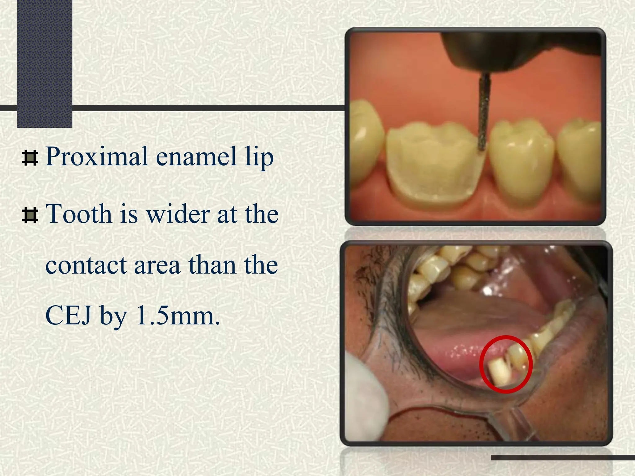 Biomechanical Principles of Tooth Preparation in FPD.ppt