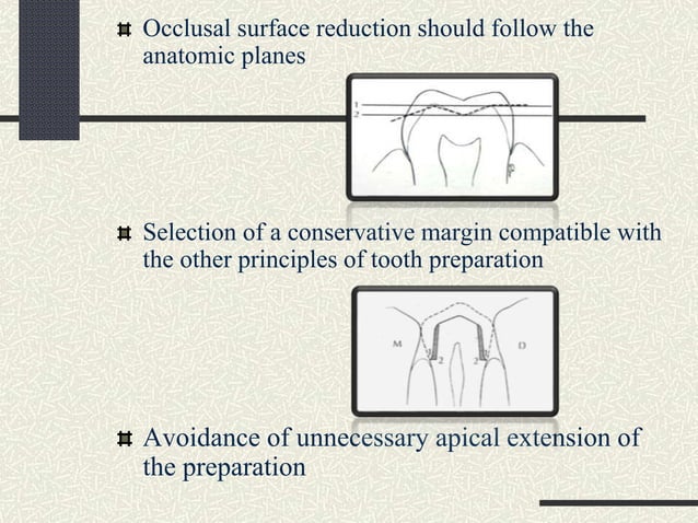 Biomechanical Principles of Tooth Preparation in FPD.ppt