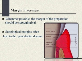 Biomechanical Principles of Tooth Preparation in FPD.ppt