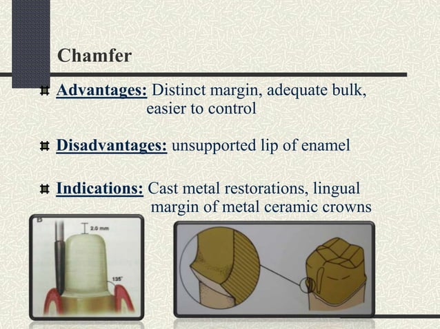 Biomechanical Principles of Tooth Preparation in FPD.ppt