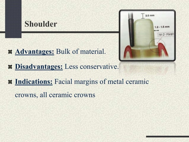 Biomechanical Principles of Tooth Preparation in FPD.ppt