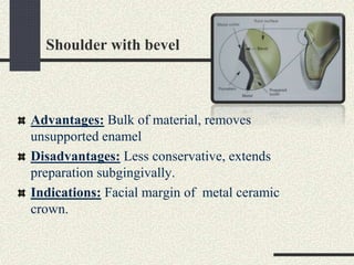 Biomechanical Principles of Tooth Preparation in FPD.ppt