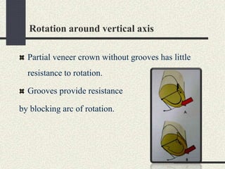 Biomechanical Principles of Tooth Preparation in FPD.ppt