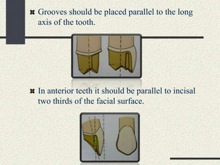 Biomechanical Principles of Tooth Preparation in FPD.ppt