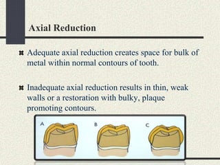 Biomechanical Principles of Tooth Preparation in FPD.ppt