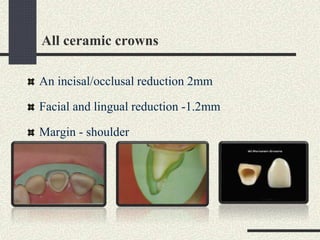 Biomechanical Principles of Tooth Preparation in FPD.ppt