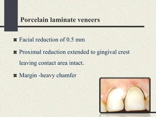 Biomechanical Principles of Tooth Preparation in FPD.ppt