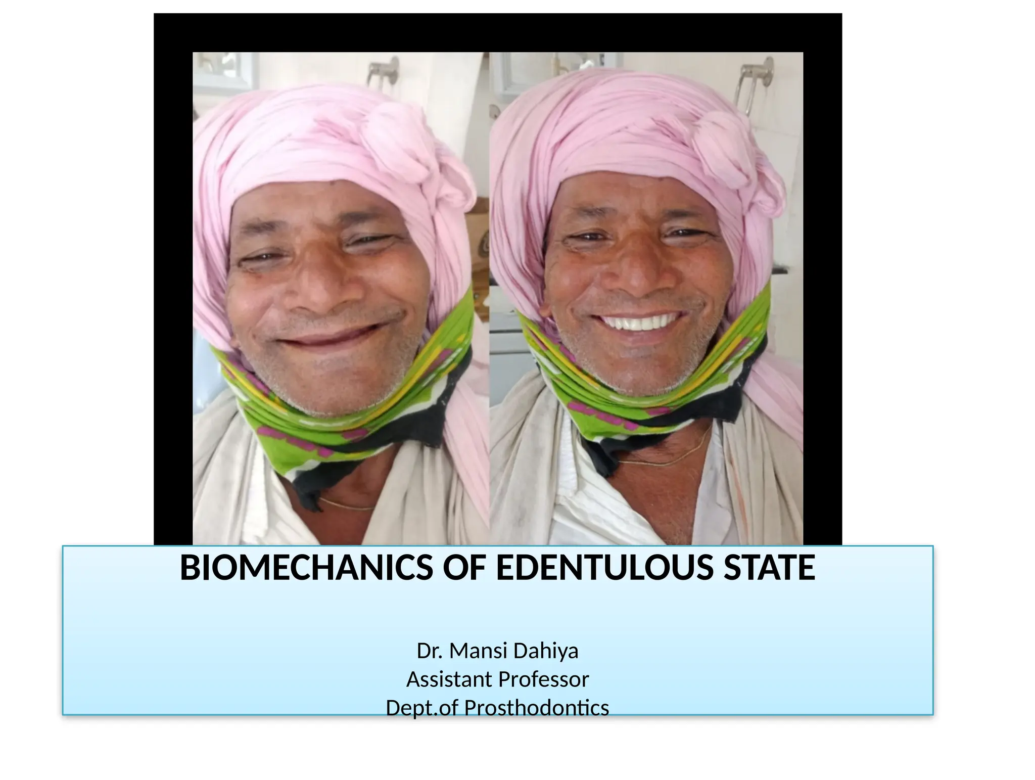 Biomechanic of Edentulous state easy.pptx