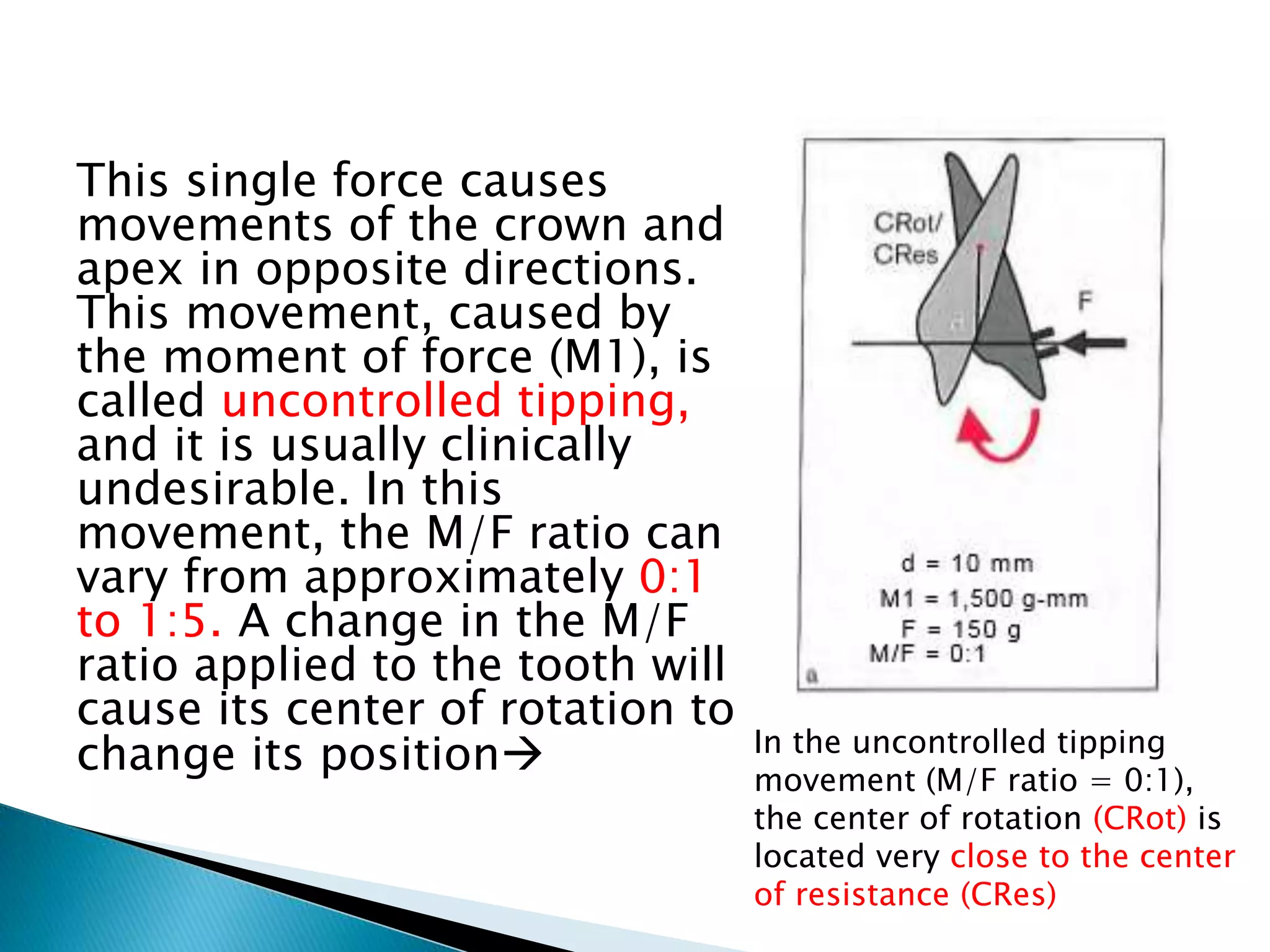 Orthodontic Biomechanics | PPTX