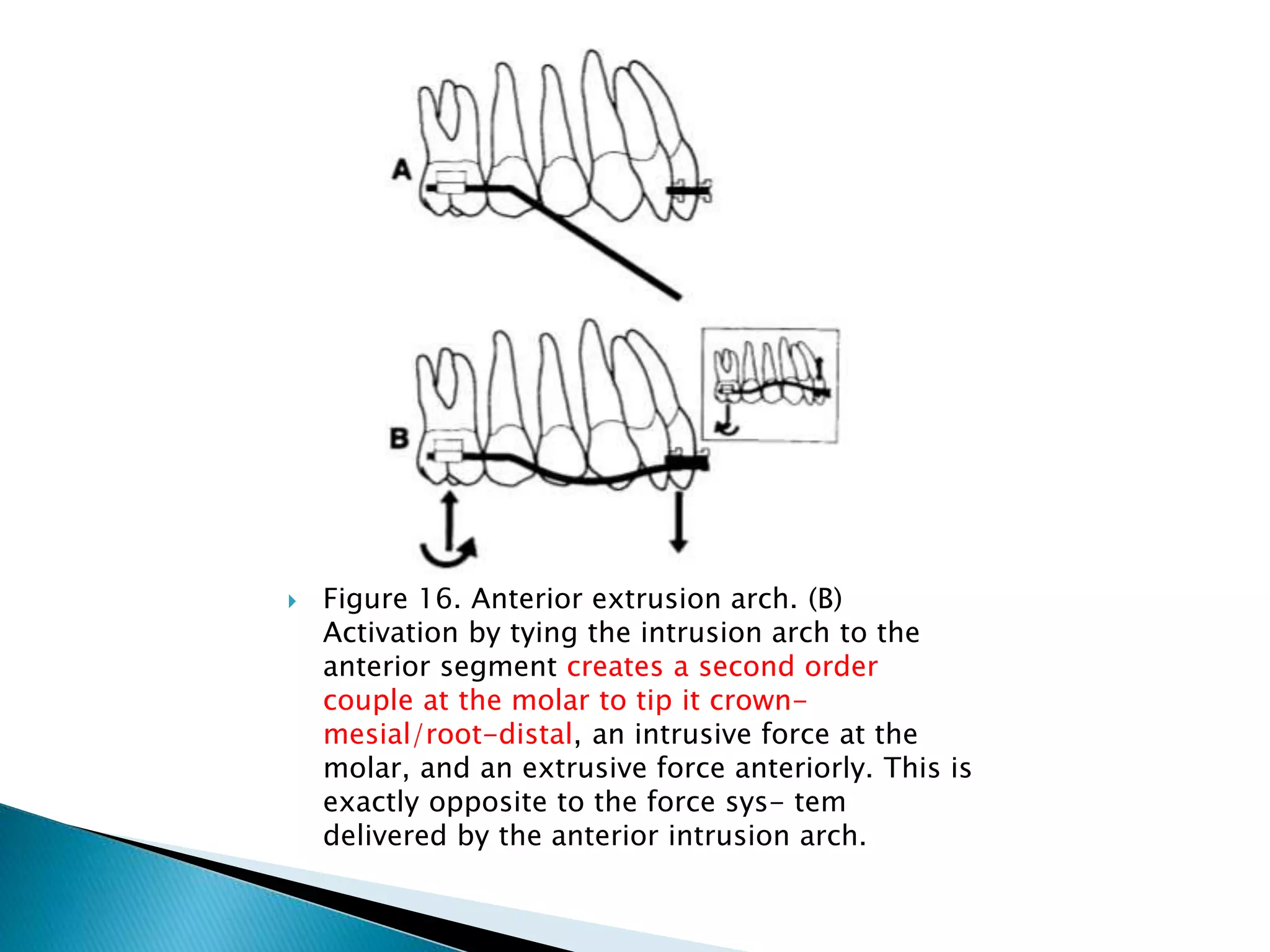 Orthodontic Biomechanics | PPTX