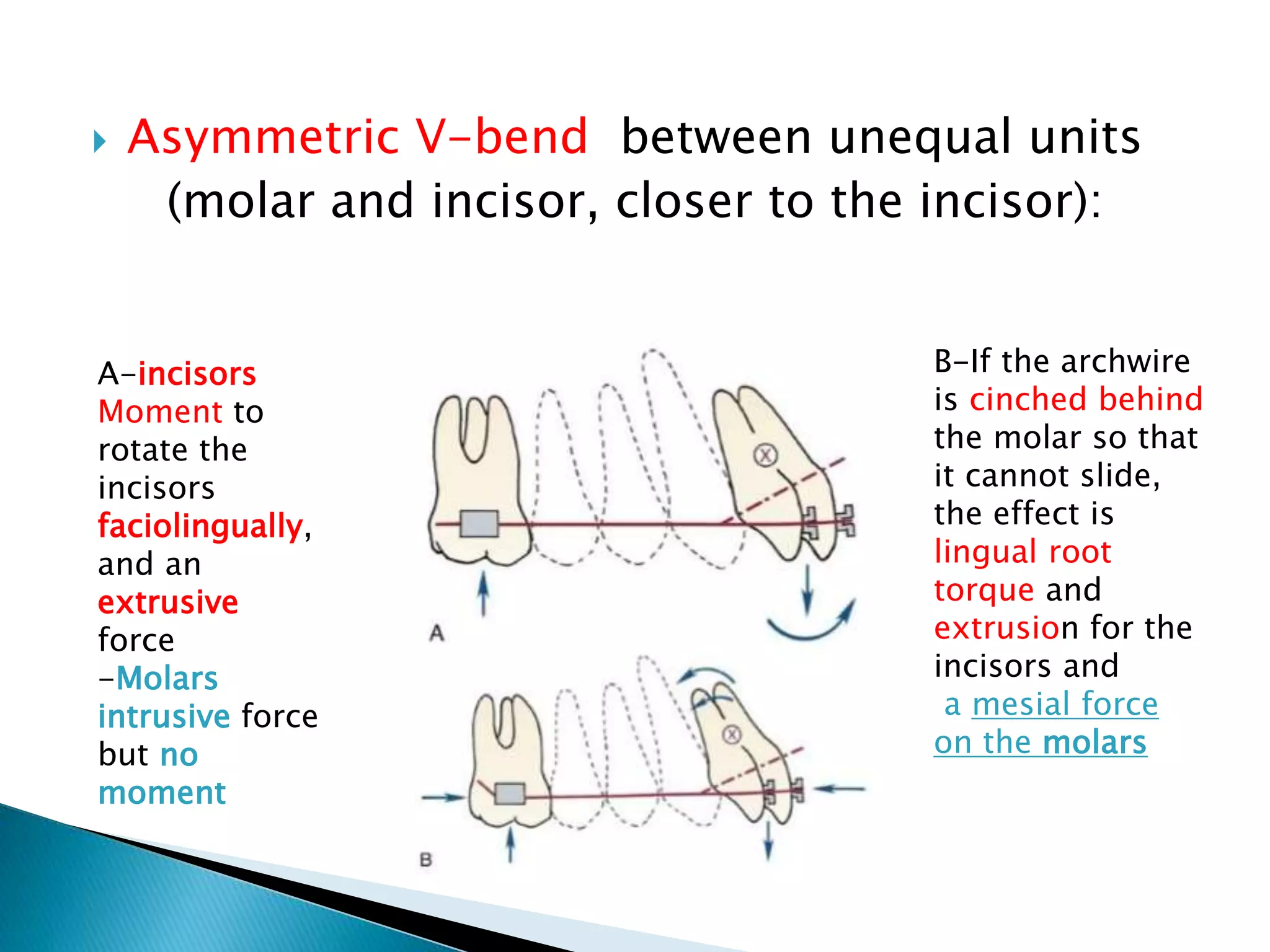 Orthodontic Biomechanics | PPTX