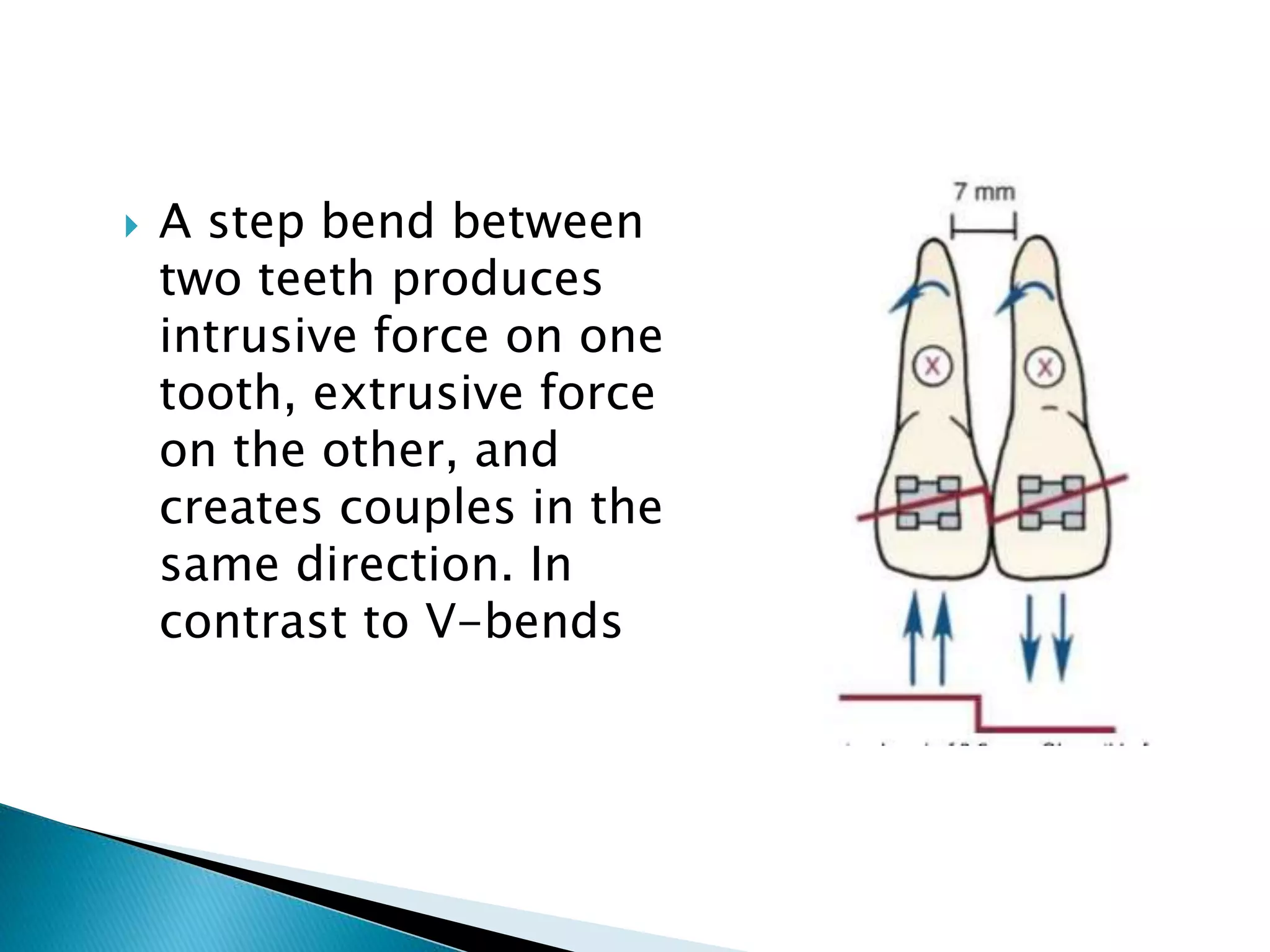 Orthodontic Biomechanics | PPTX