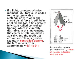 Orthodontic Biomechanics | PPTX