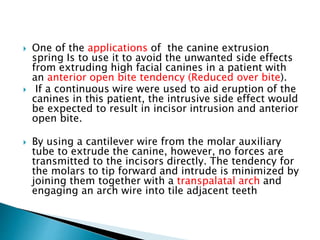 Orthodontic Biomechanics | PPTX