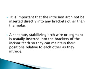 Orthodontic Biomechanics | PPTX