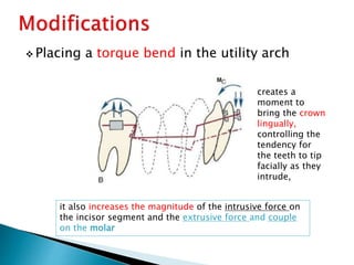 Orthodontic Biomechanics | PPTX
