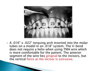Orthodontic Biomechanics | PPTX