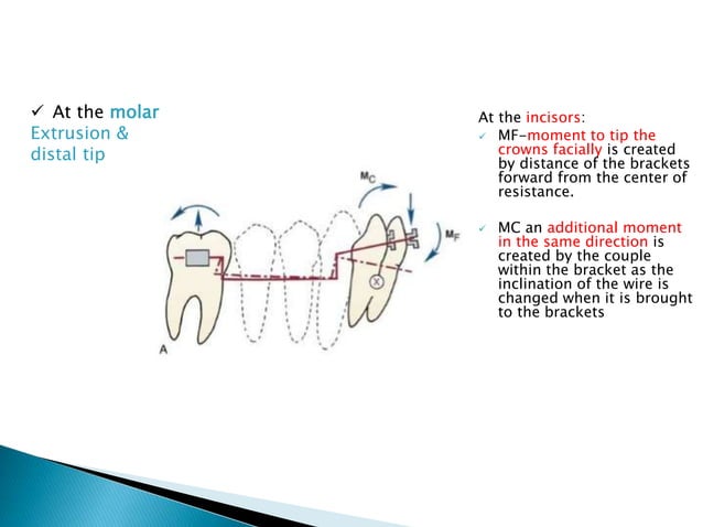 Orthodontic Biomechanics