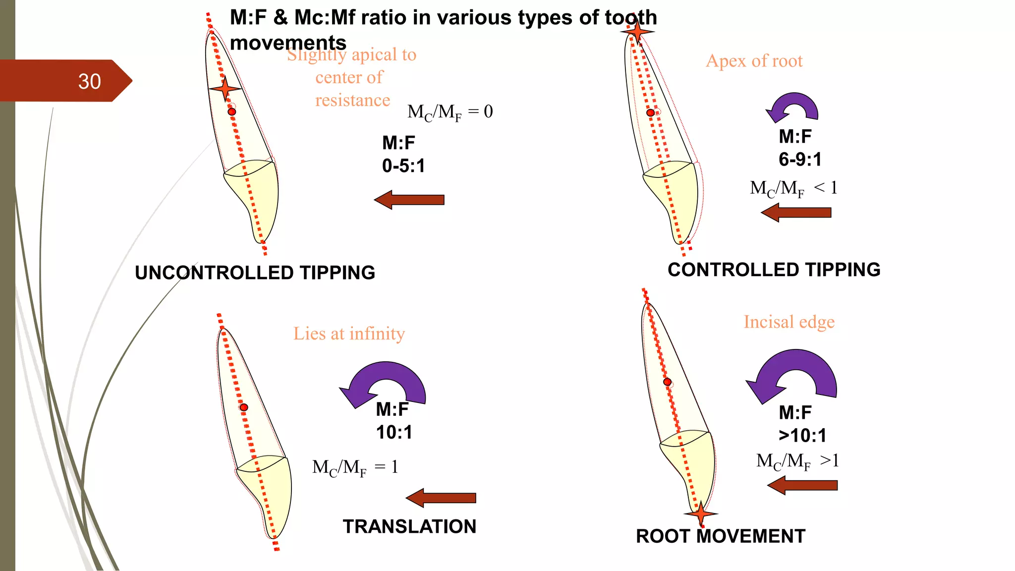 Biomechanics in orthodontics | PPTX