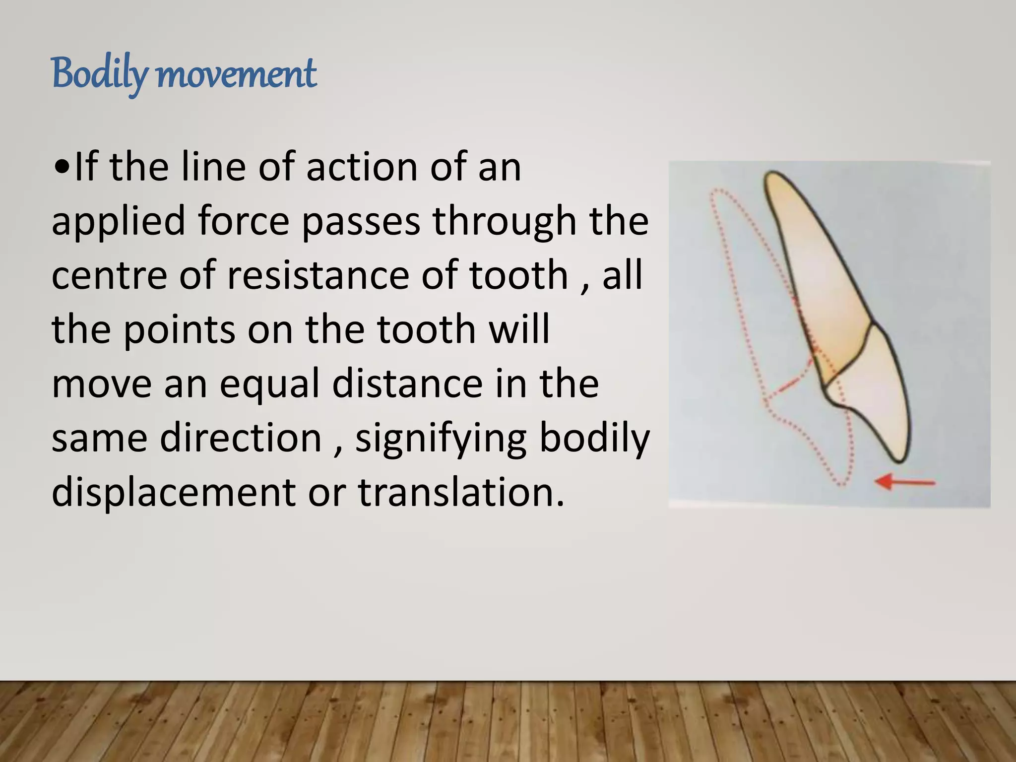 Biomechanics in Orthodontic tooth movements | PPTX