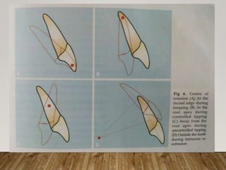 Biomechanics in Orthodontic tooth movements | PPTX