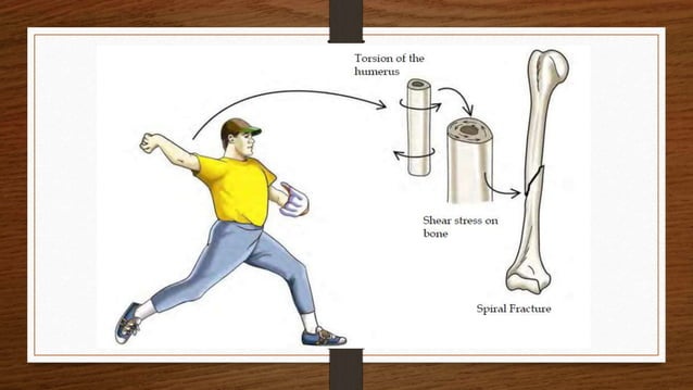 Kinetic Concepts for Analyzing Human Motion. (Biomechanics)