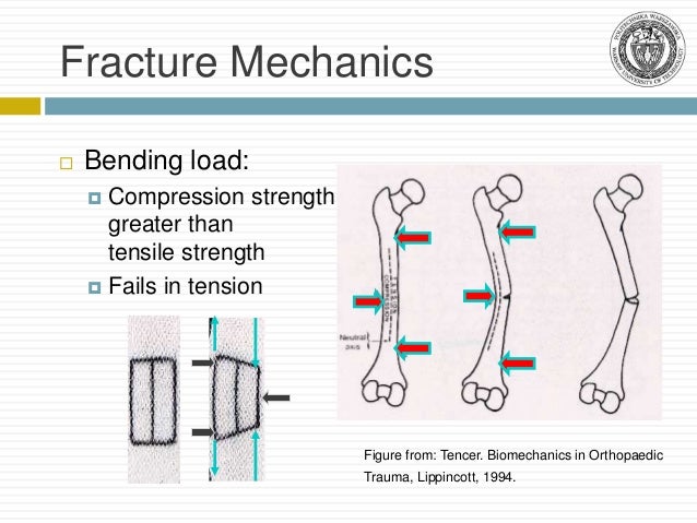 Biomechanics of Bones