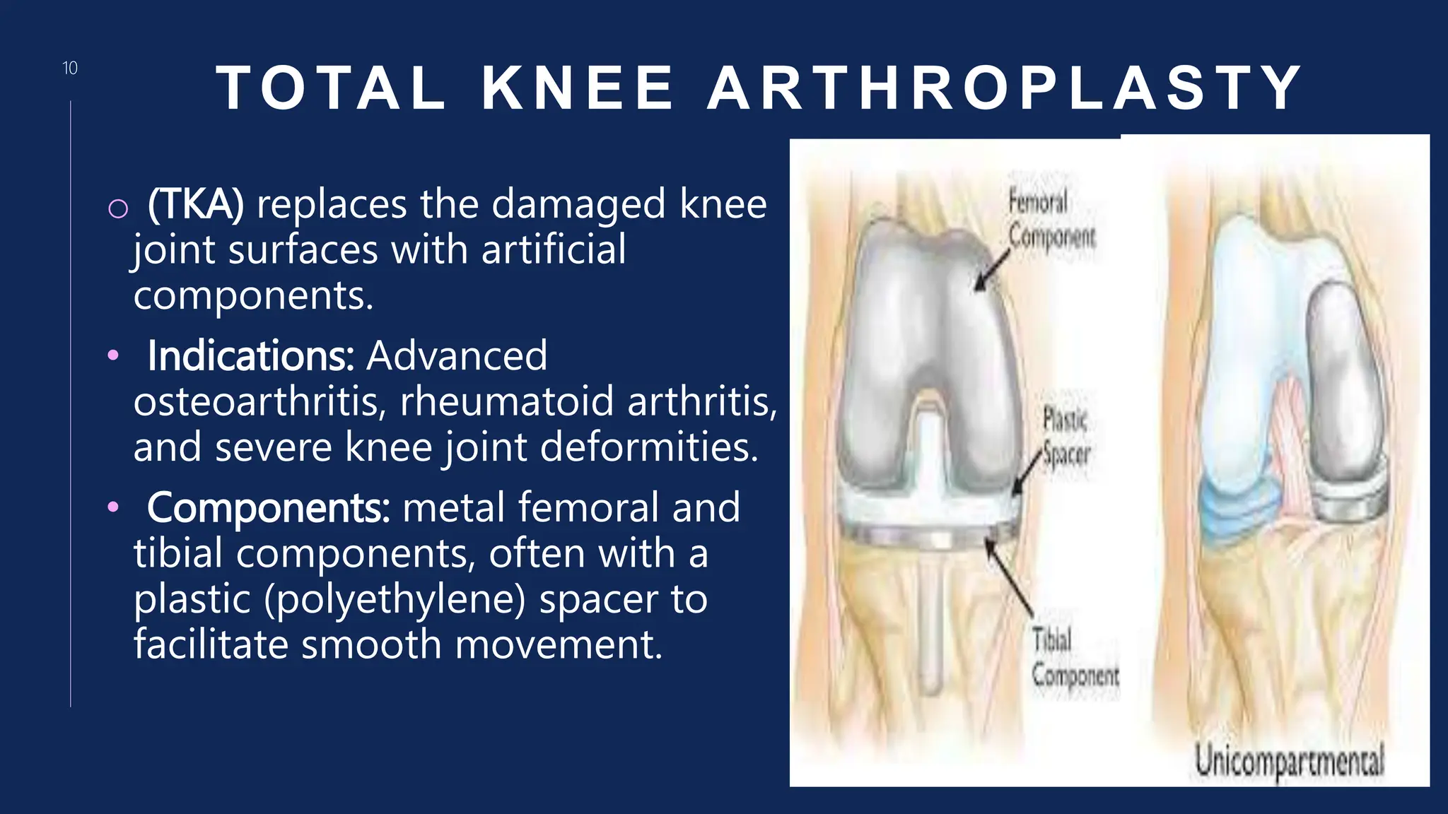 Arthroplasty and its types/ total joint replacement | PPTX