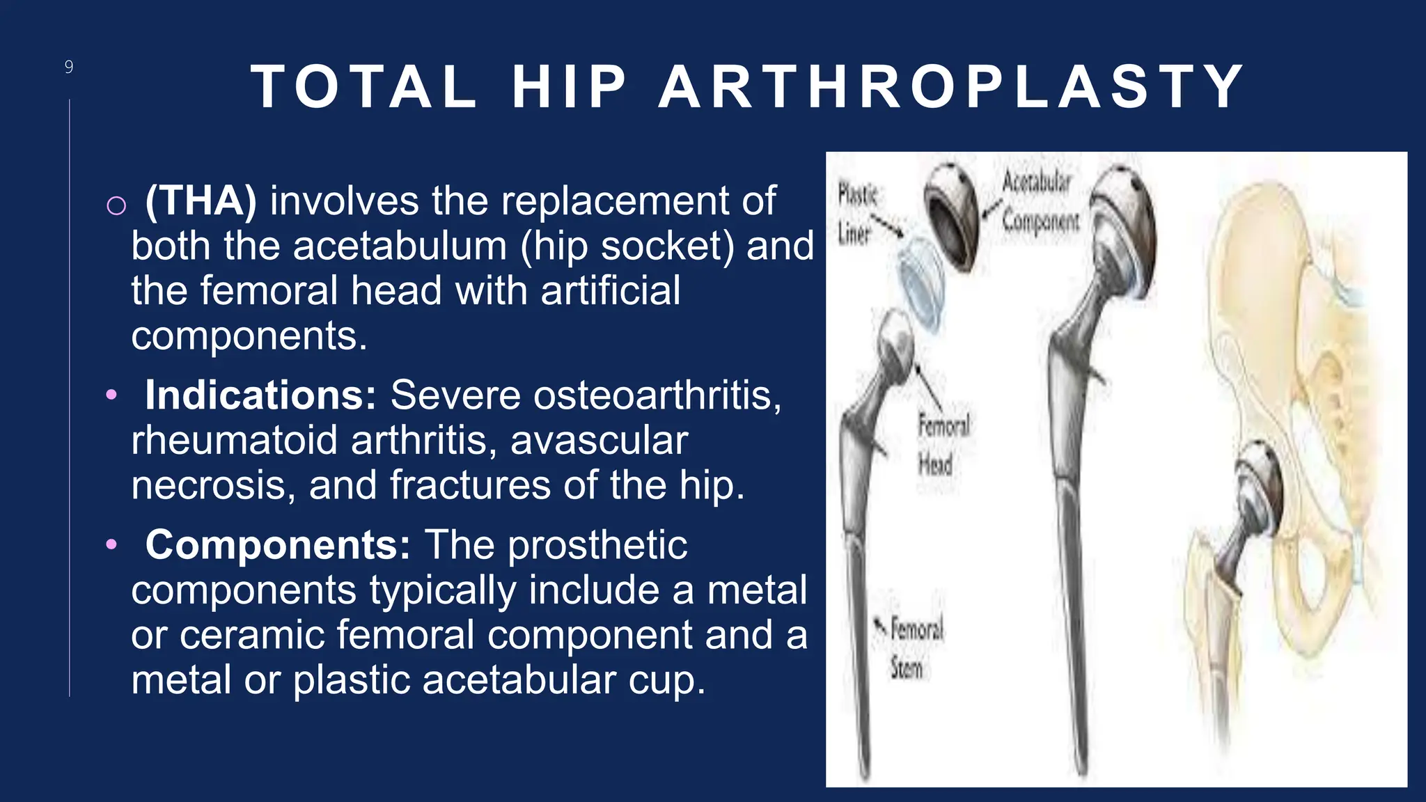 Arthroplasty and its types/ total joint replacement | PPTX