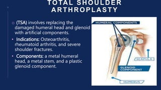 Arthroplasty and its types/ total joint replacement | PPTX