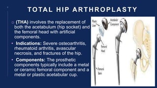 Arthroplasty and its types/ total joint replacement | PPTX