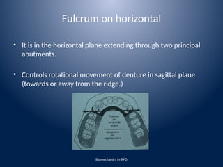 biomechanics of removable partial denture | PPTX