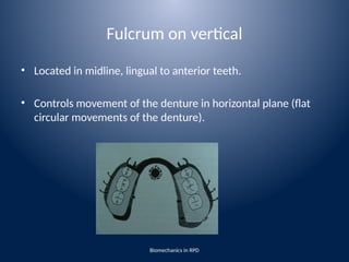 biomechanics of removable partial denture | PPTX