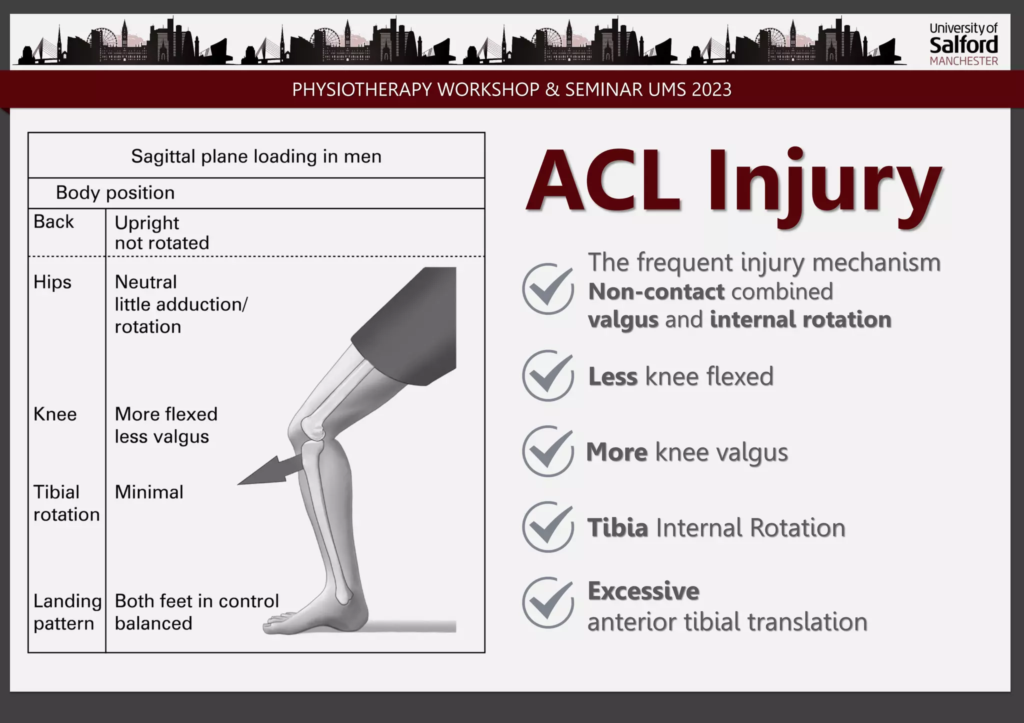 Biomechanics ACL.pptx