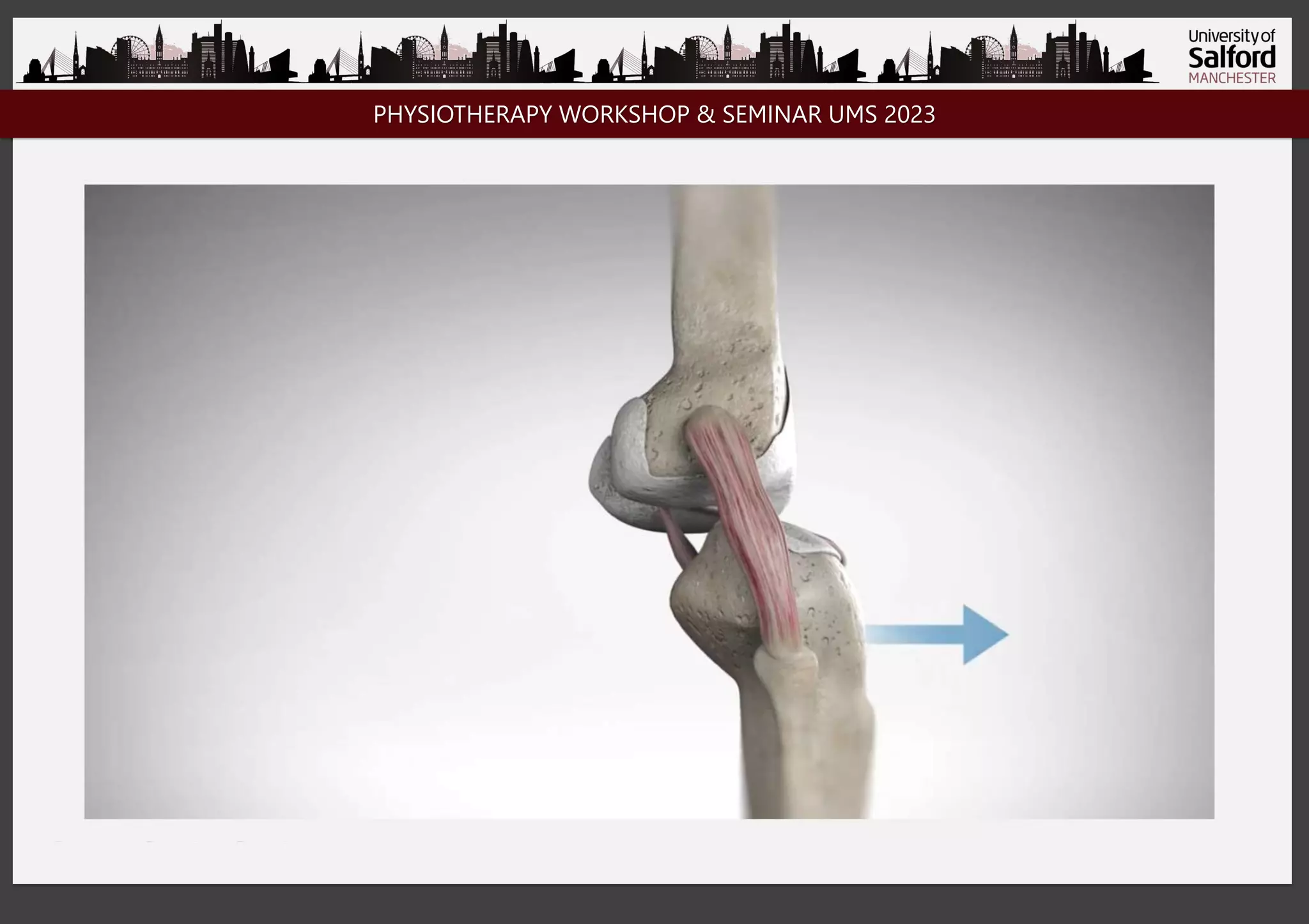 Biomechanics ACL.pptx