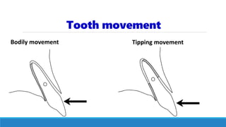 Biomechanics and mechanics of tooth movement | PPTX