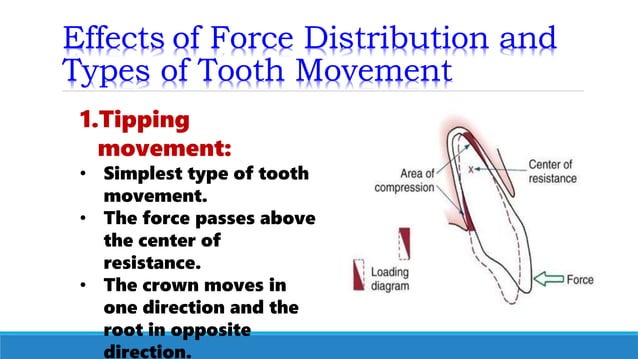 Biomechanics and mechanics of tooth movement | PPTX