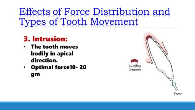 Biomechanics and mechanics of tooth movement | PPTX