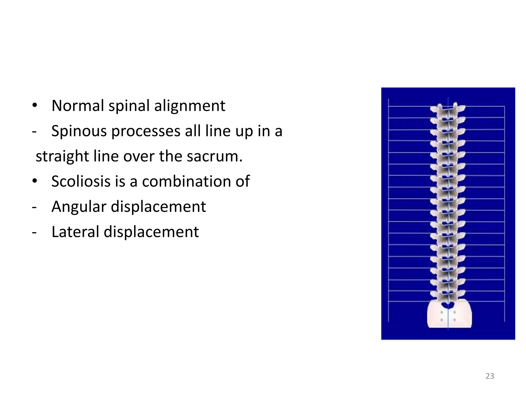 Biomechanics and pathomechanics of scoliosis | PPTX