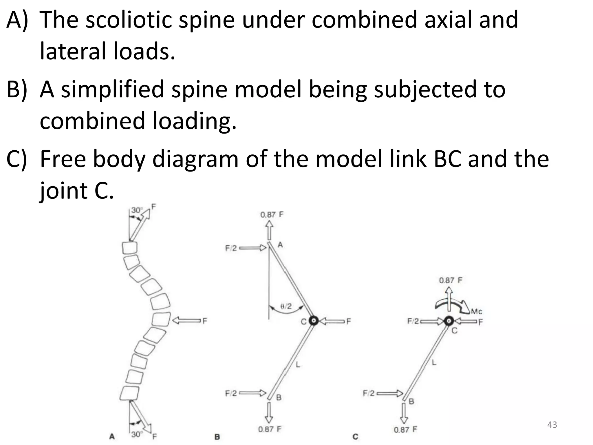 Biomechanics and pathomechanics of scoliosis | PPTX