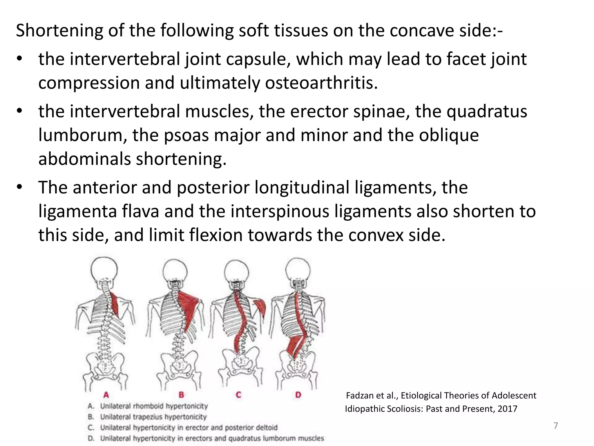 Biomechanics and pathomechanics of scoliosis | PPTX