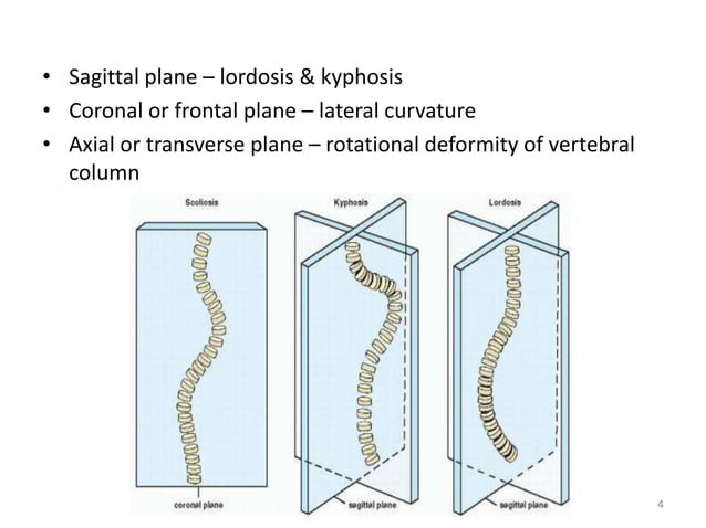 Biomechanics and pathomechanics of scoliosis | PPTX