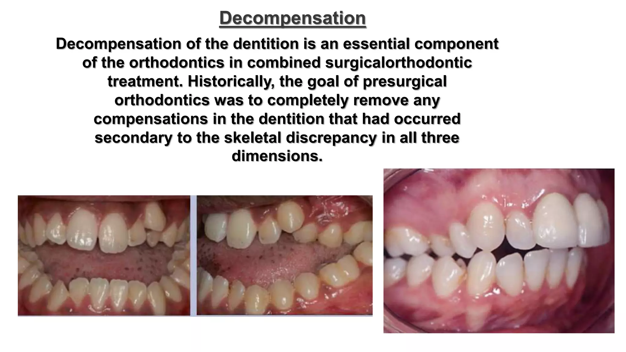 Biomechanics and treatment of skeletal deformities part 2 | PPT