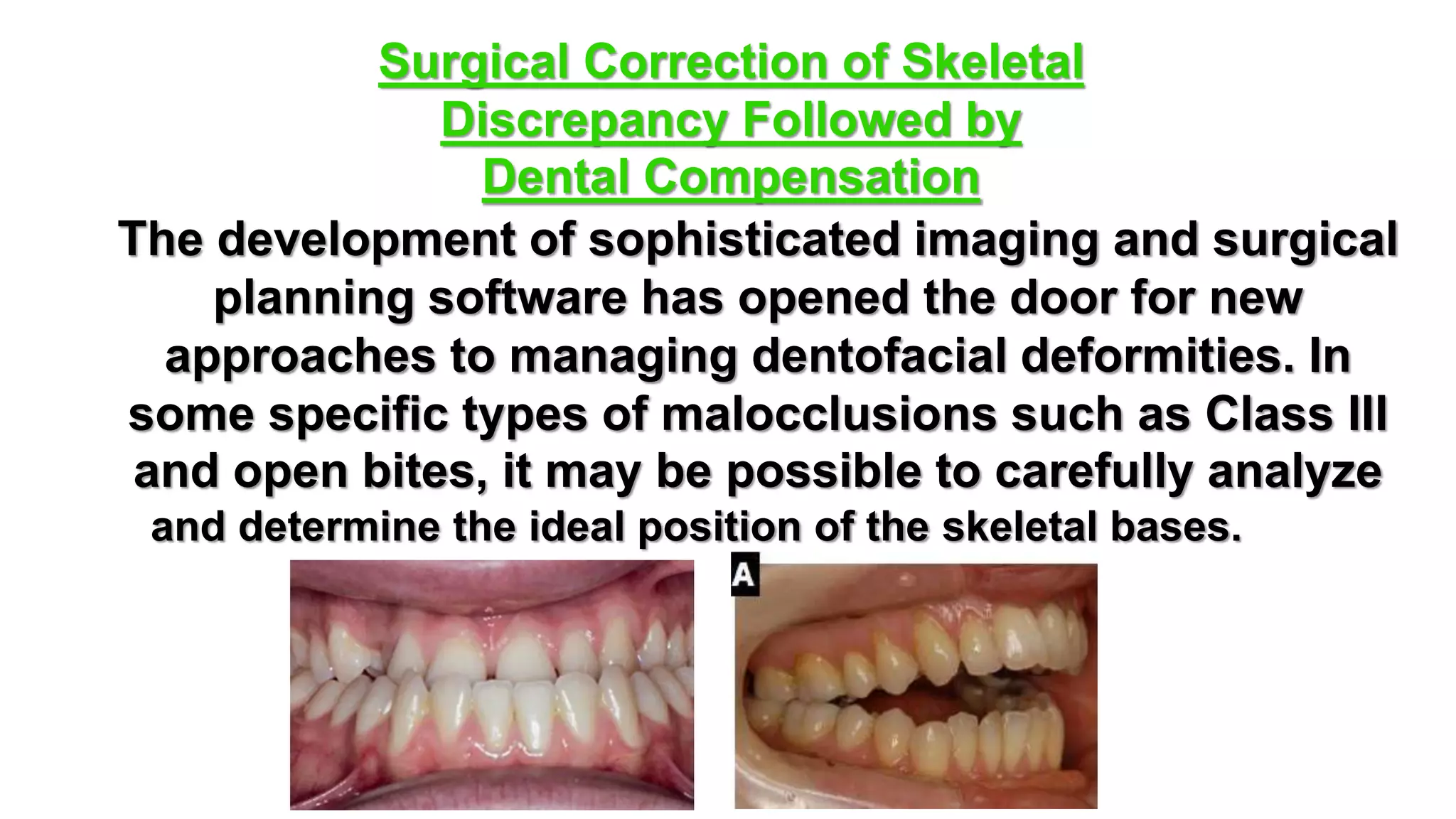 Biomechanics and treatment of skeletal deformities part 2 | PPT