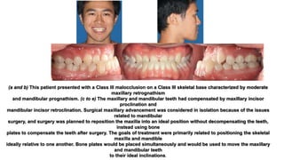 Biomechanics and treatment of skeletal deformities part 2 | PPTX