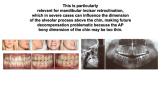 Biomechanics and treatment of skeletal deformities part 2 | PPTX